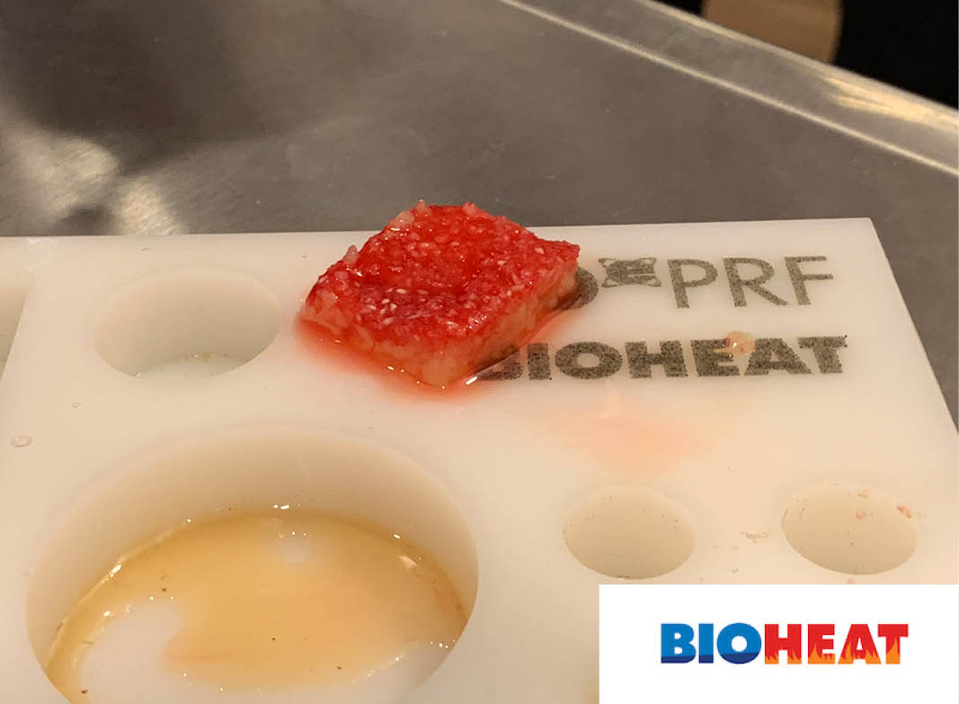 Bio-Heat Science - BioPRF EU